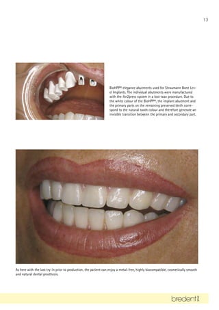 000534GB_BioHPP elegance Hybridabutments.pdf
