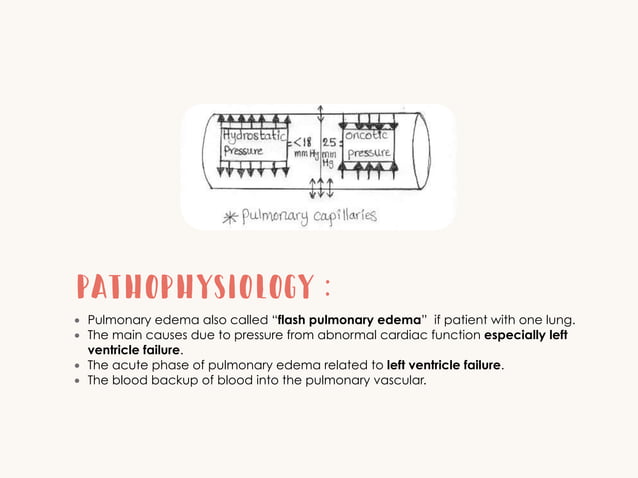 Pulmonary Edema. | PDF