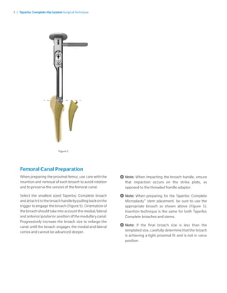 0019.2-GLBL-en Taperloc Complete Surg Tech1.pdf