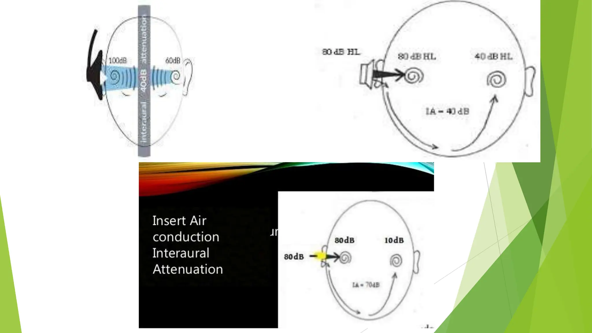 Audiology (pure tone audiometry, speech audiometry) .pptx