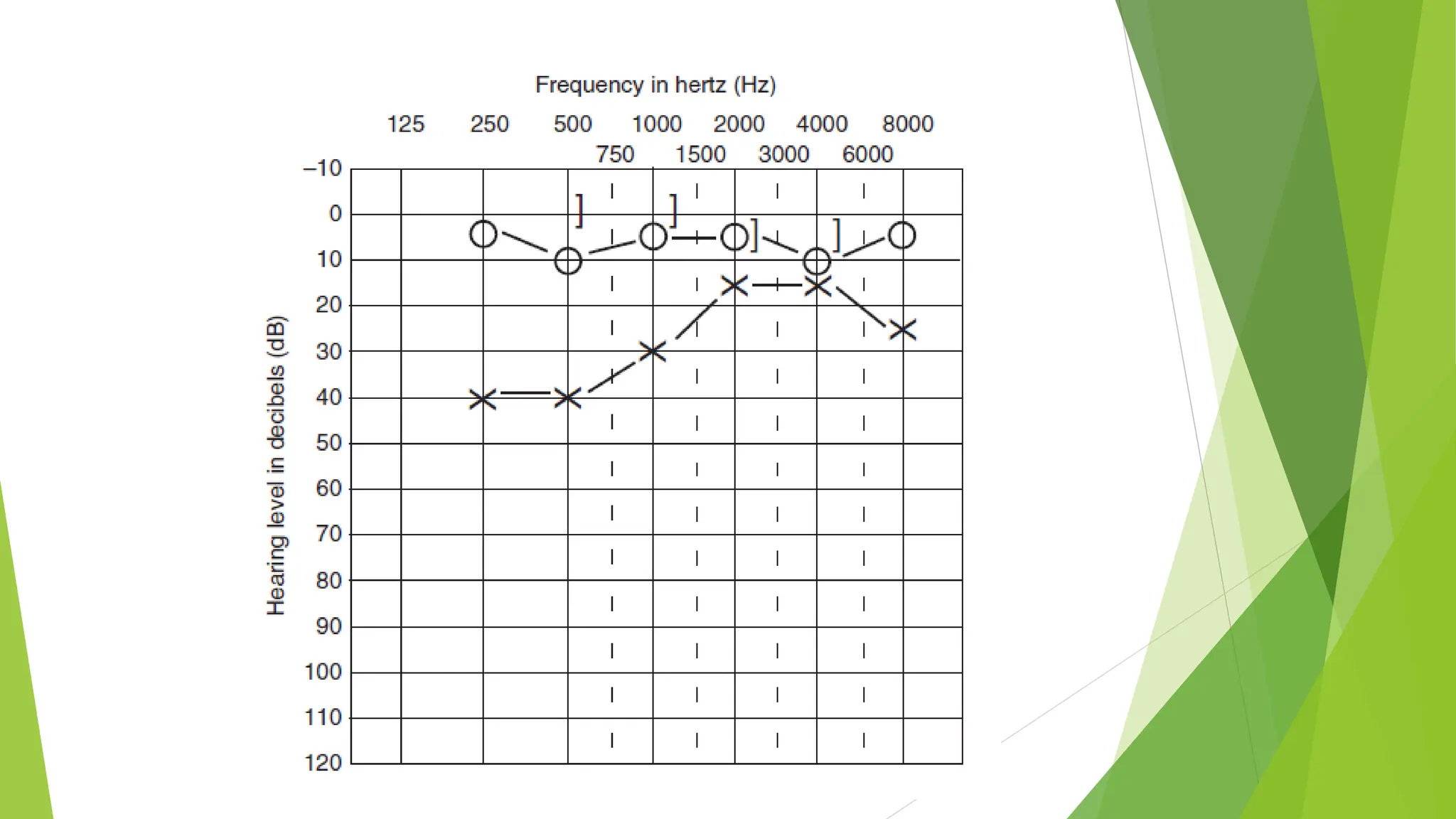 Audiology (pure tone audiometry, speech audiometry) .pptx