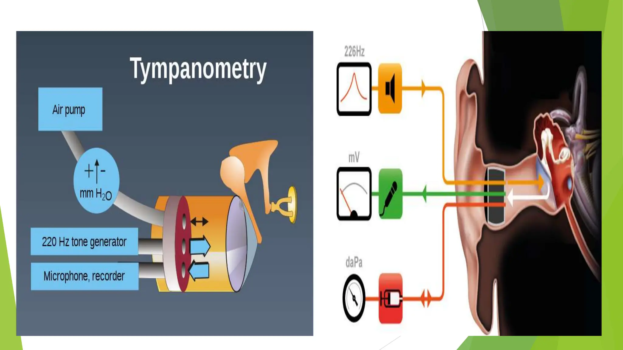 Audiology (pure tone audiometry, speech audiometry) .pptx
