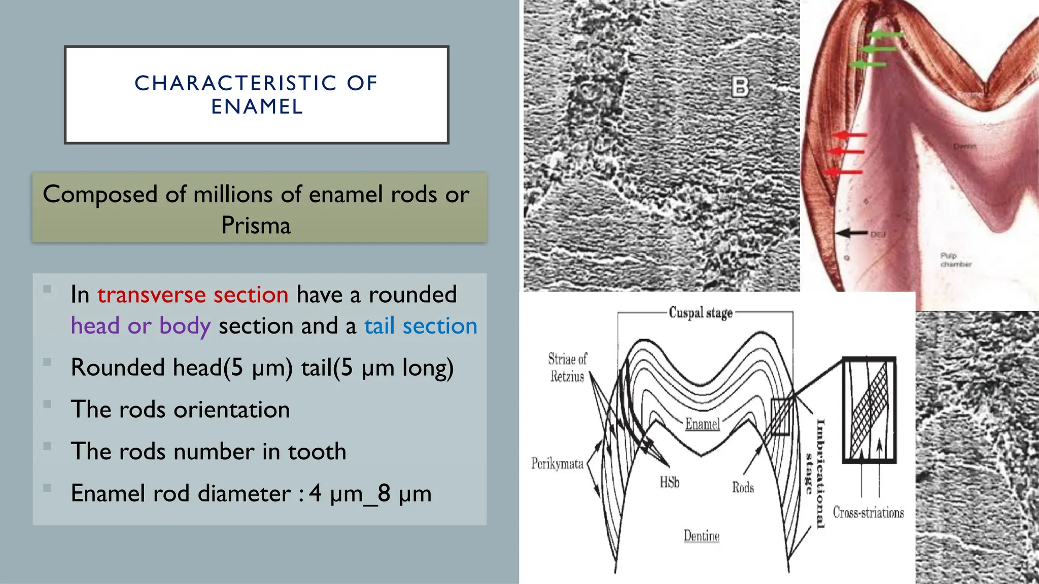 001 Enamel hypoplasiaffd [Autosaved].pptx
