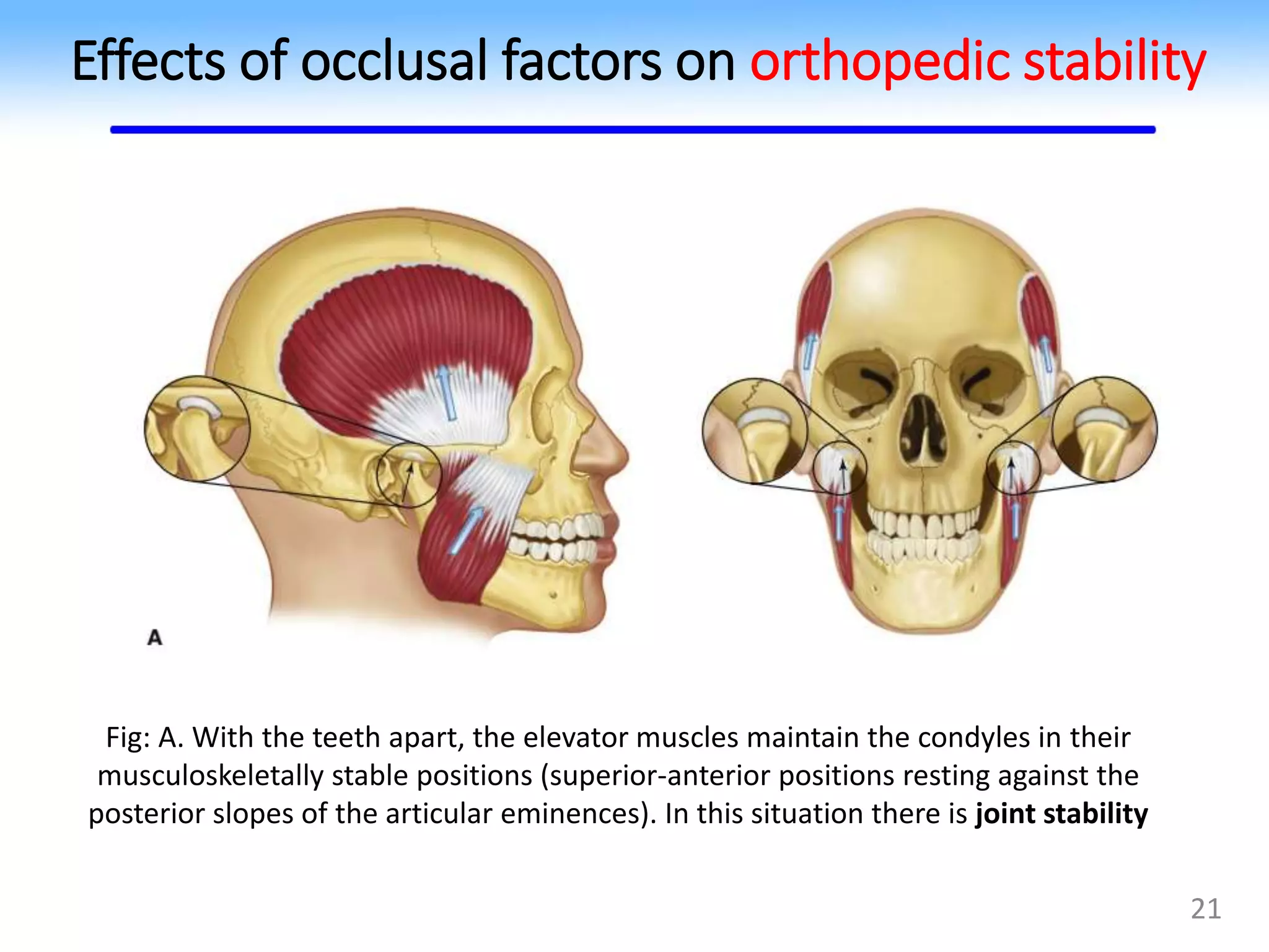 Temporomandibular Dysfunctions – Part 1(Etiology, Sign and Symptoms) | PPTX | Dental Health ...
