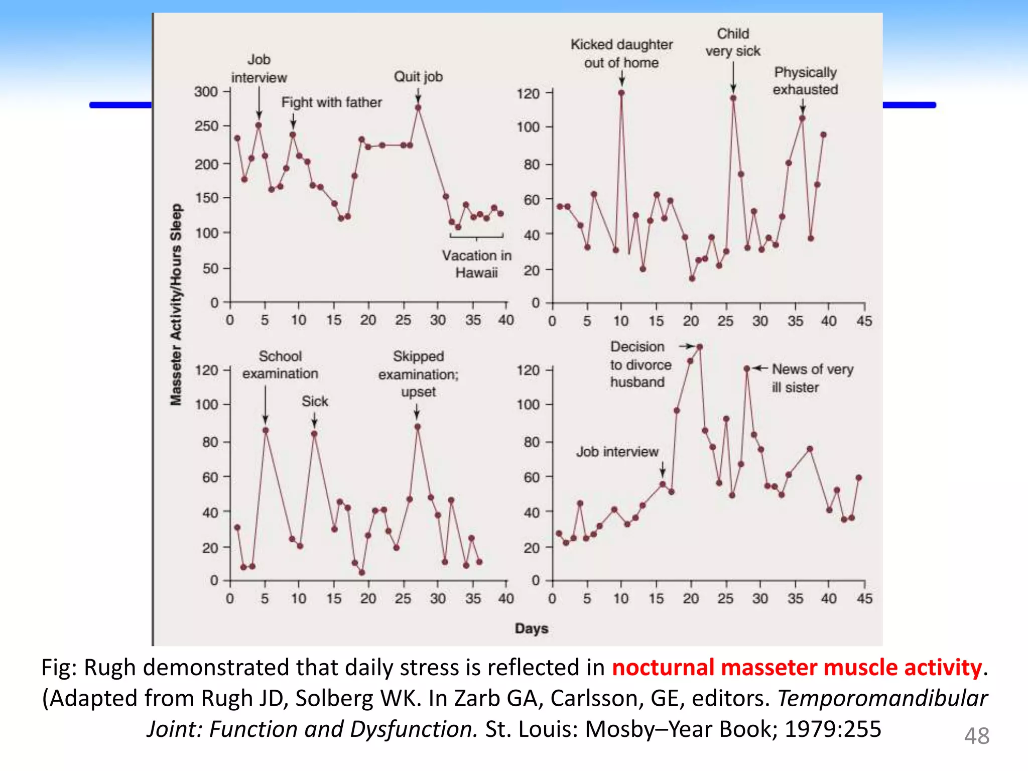 Temporomandibular Dysfunctions – Part 1(Etiology, Sign and Symptoms) | PPTX