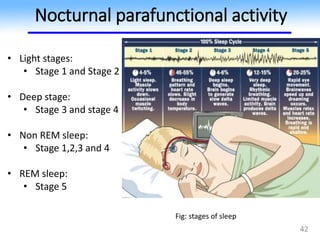 Temporomandibular Dysfunctions – Part 1(Etiology, Sign and Symptoms) | PPTX