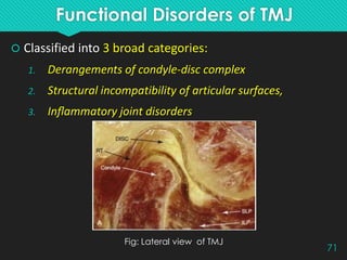 Temporomandibular Dysfunctions – Part 1(Etiology, Sign and Symptoms) | PPTX