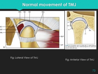 Temporomandibular Dysfunctions – Part 1(Etiology, Sign and Symptoms) | PPTX