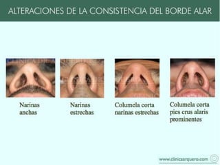 ANATOMIA DE CORTE - Regiones Superficiales de la Cara | PDF