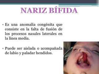 ANATOMIA DE CORTE - Regiones Superficiales de la Cara | PDF