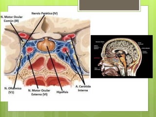 ANATOMIA DE CORTE - Regiones Superficiales de la Cara | PDF