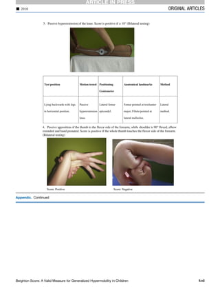 Beighton score | PDF