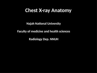 Chest Radiographic Anatomy for radiology rotation | PPTX