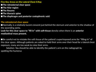 Chest Radiographic Anatomy for radiology rotation | PPTX