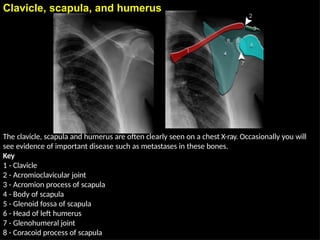 Chest Radiographic Anatomy for radiology rotation | PPTX