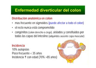 002 enfermedad diverticular colon | PDF