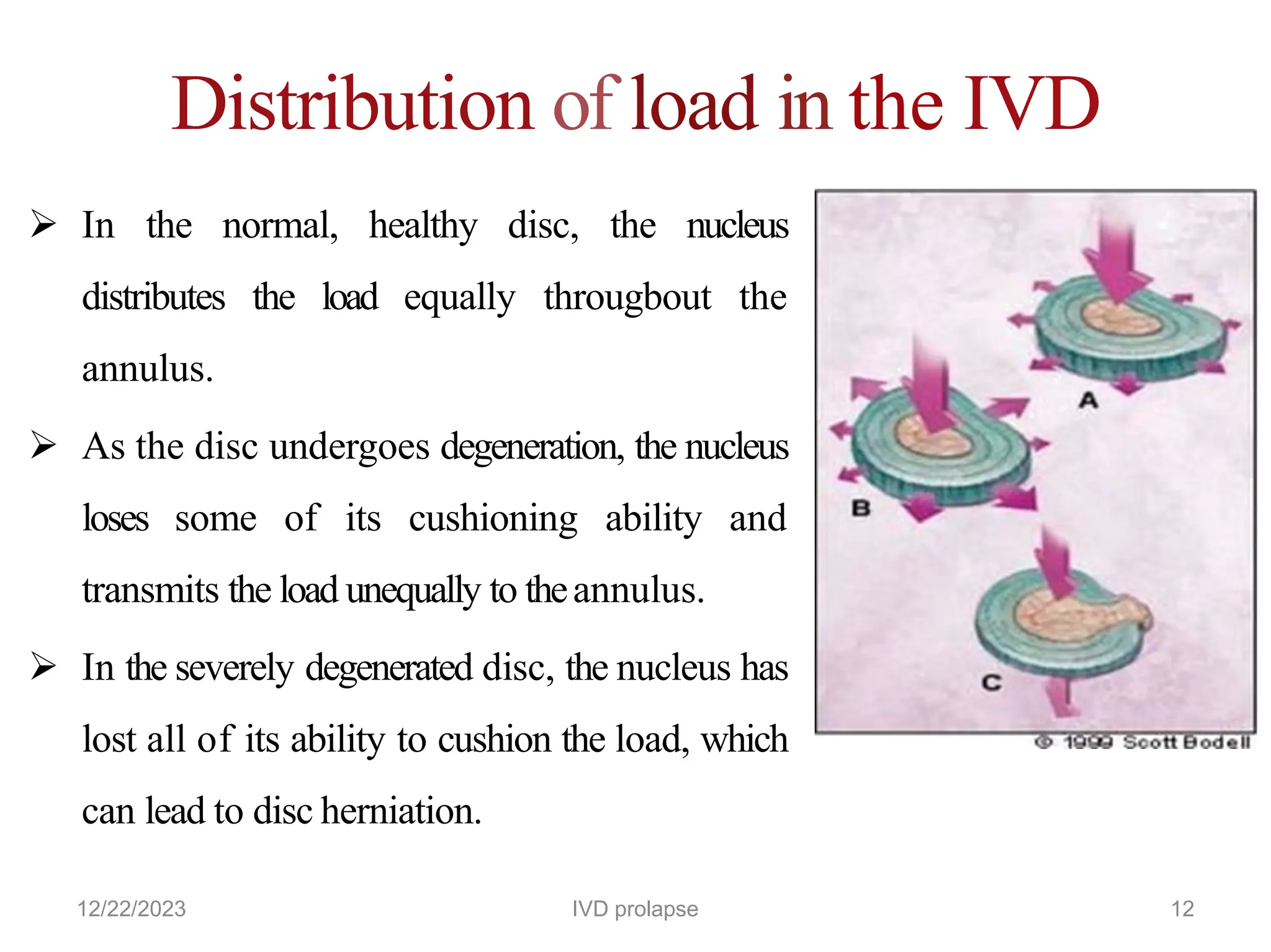 002_Intervertebral-disc-prolapse ppt.pdf