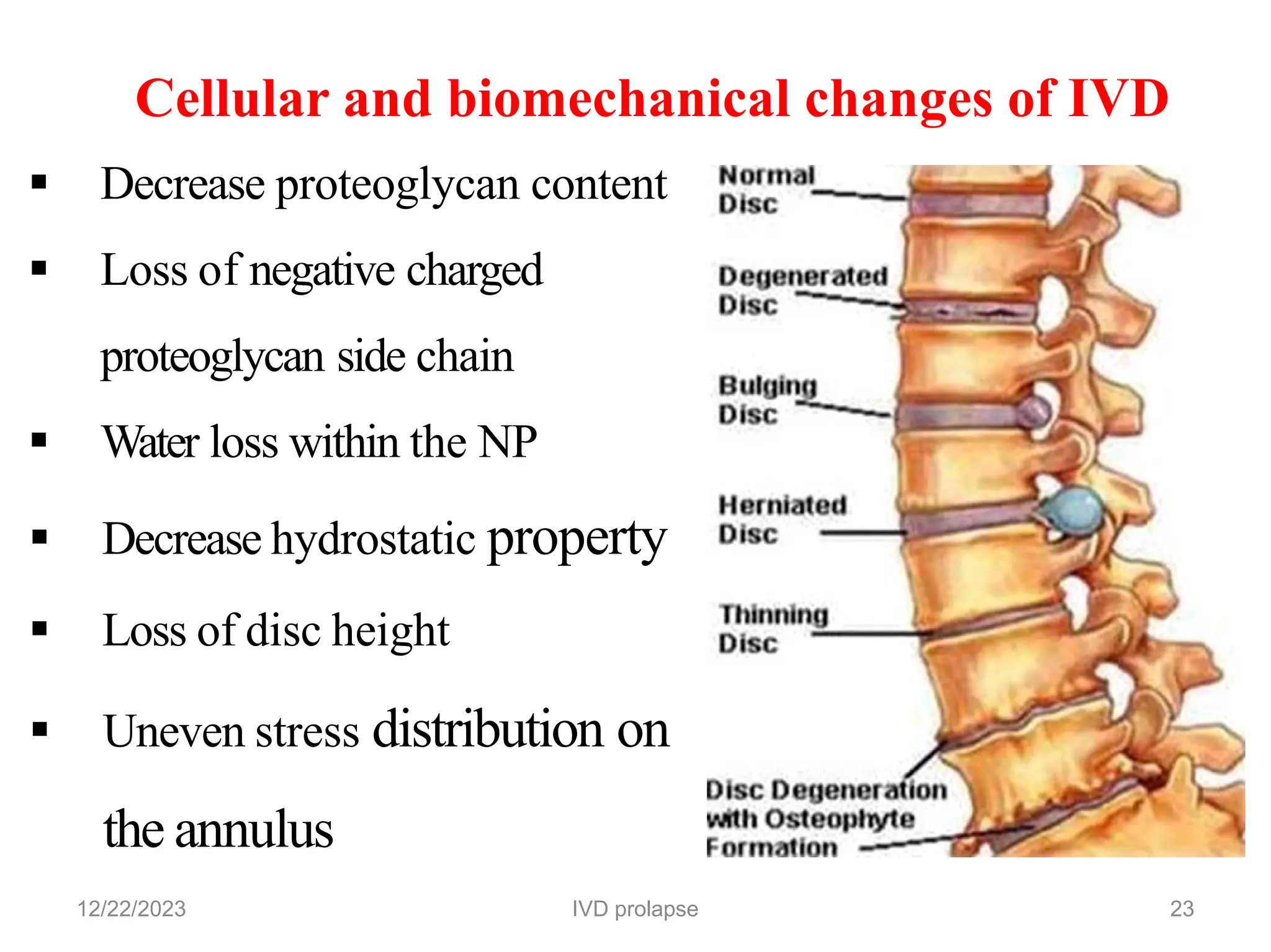 002_Intervertebral-disc-prolapse ppt.pdf