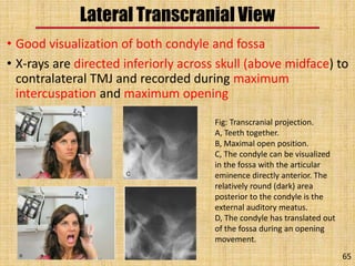 Temporomandibular Dysfunctions – Part 2 History, Clinical Examination ...