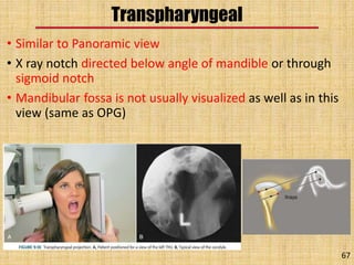 Temporomandibular Dysfunctions – Part 2 History, Clinical Examination ...