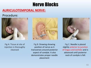 Temporomandibular Dysfunctions – Part 2 History, Clinical Examination ...