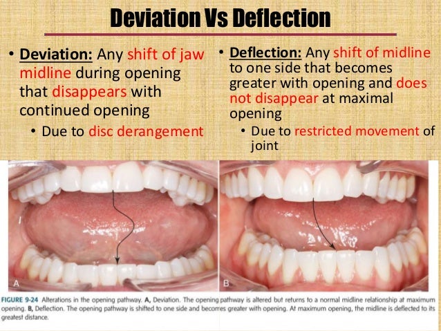 Temporomandibular Dysfunctions – Part 2 History, Clinical Examination…