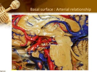 002 Surgical anatomy of the brain | PPTX