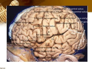 002 Surgical anatomy of the brain | PPTX