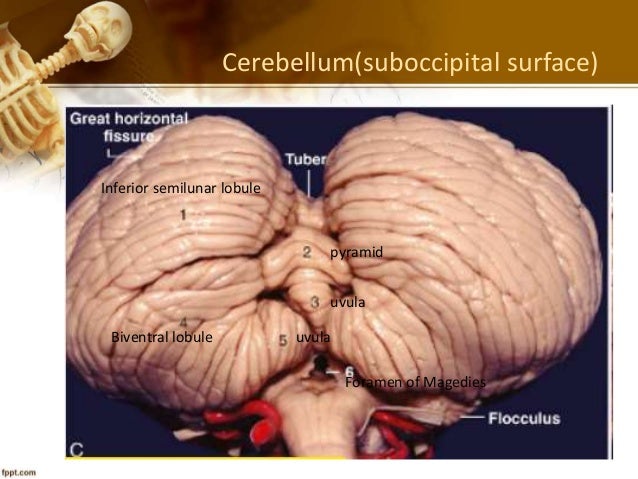 002 Surgical anatomy of the brain