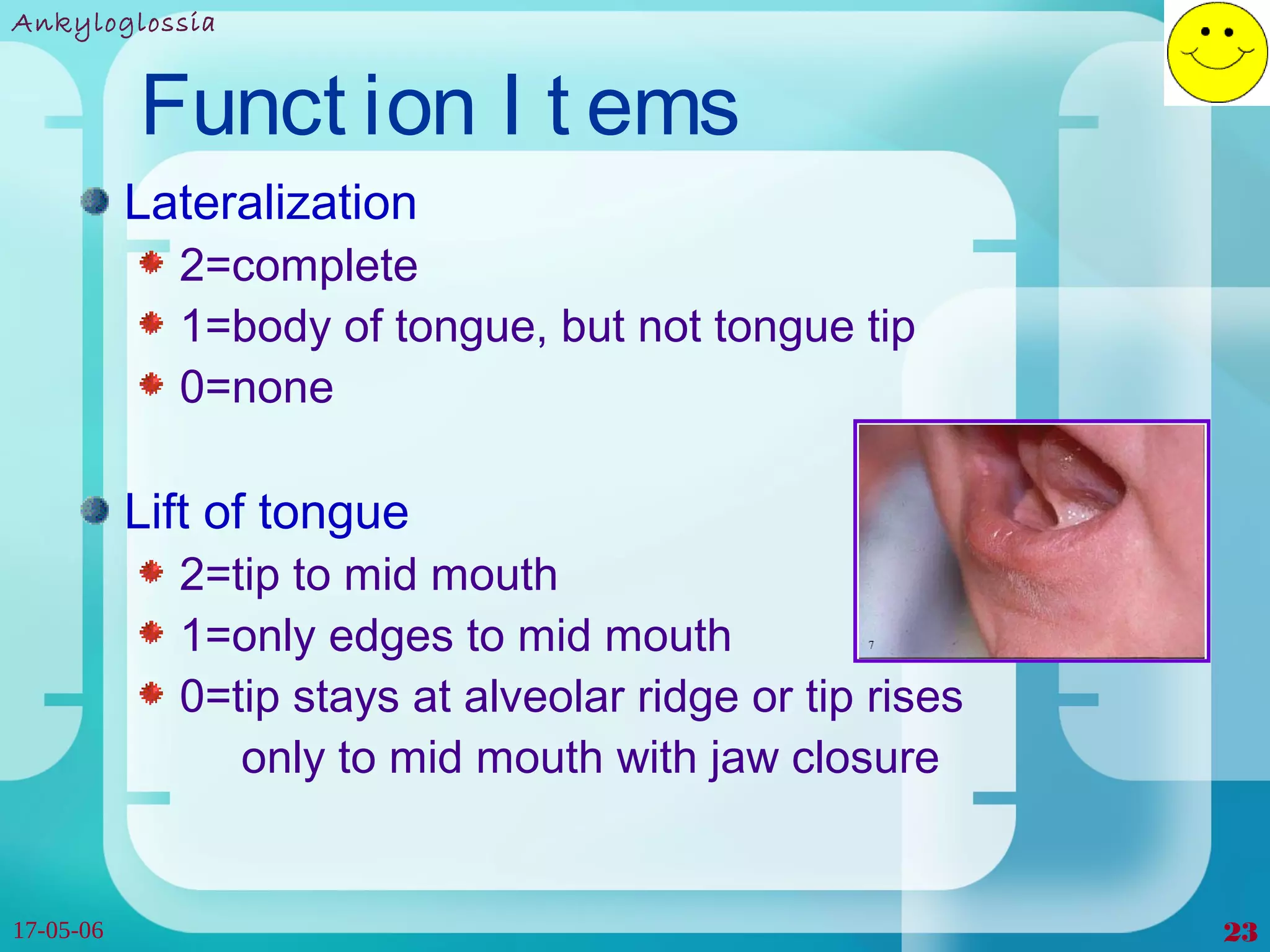 Ankyloglossia a congenital oral anomaly | PPT