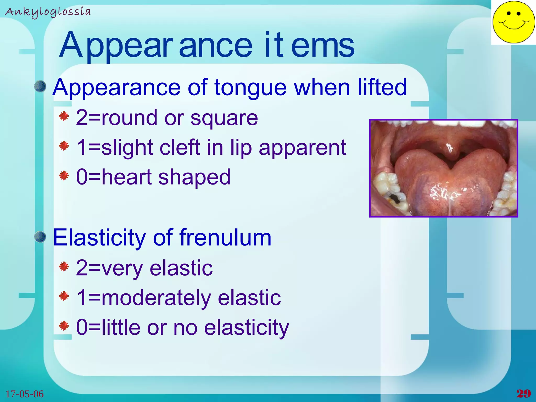 Ankyloglossia a congenital oral anomaly | PPT