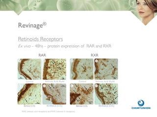 003-CHEMYUNION-PS744_1300_REVINAGE-RV03.pptx | Free Download