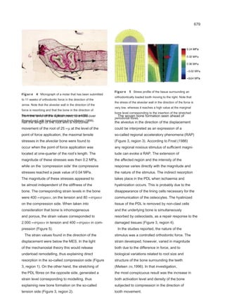 Tissue reaction to orthodontic tooth movement-a new paradigm | RTF