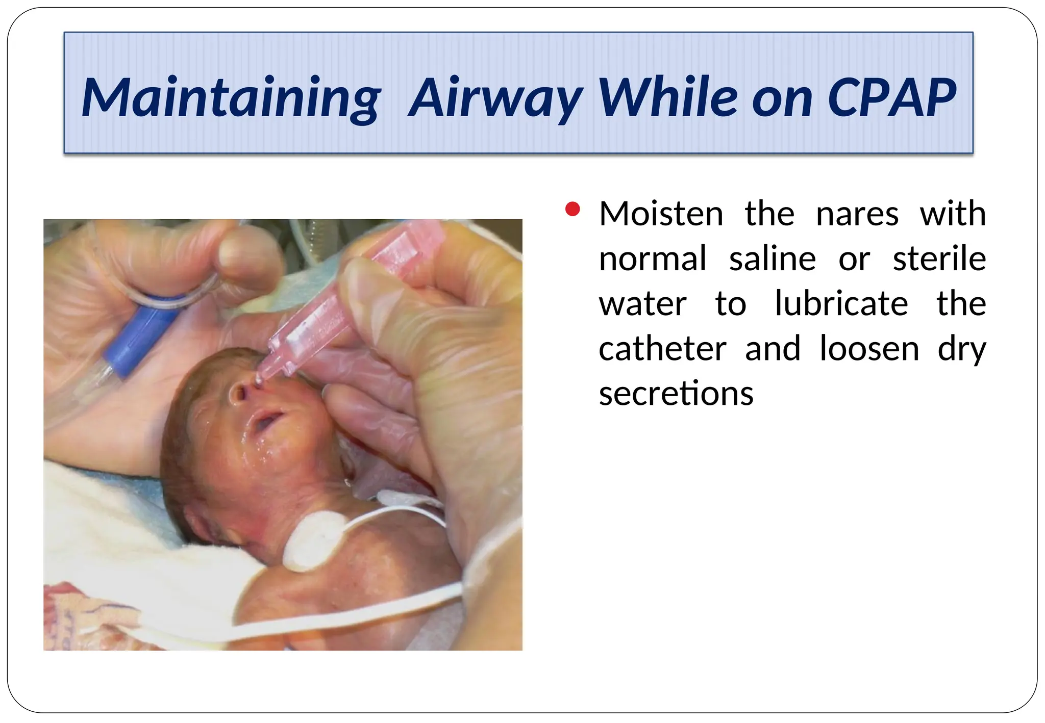 pumani bubble cpap in Malawis . RDS CARE | PPT