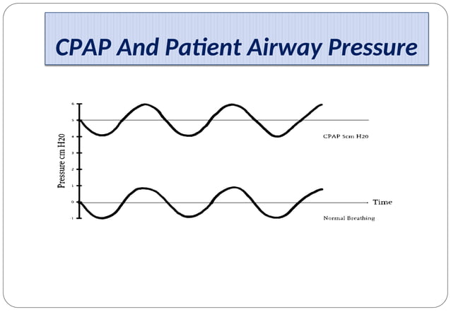 pumani bubble cpap in Malawis . RDS CARE | PPT