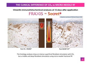 004. FRAXIS DUO PPT BY ILOODA_v190516.pdf