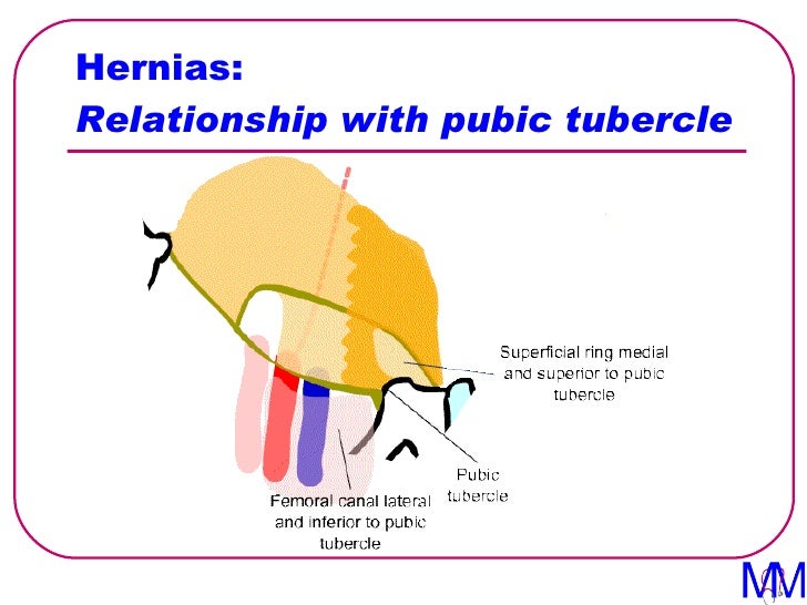 004 Hernias - Introduction to Clinical Surgery Lectures