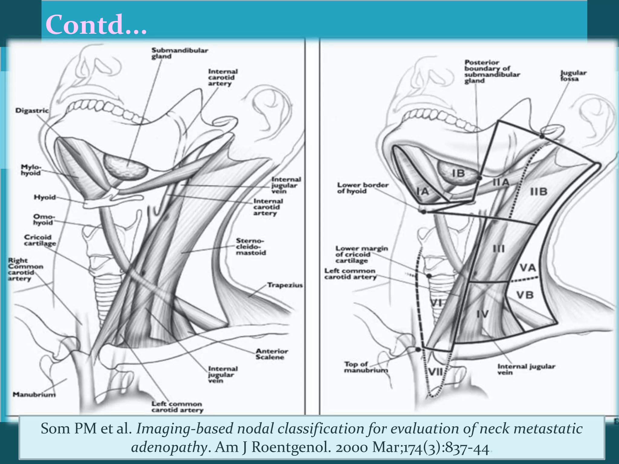 Surgical anatomy and approaches to neck | PPTX