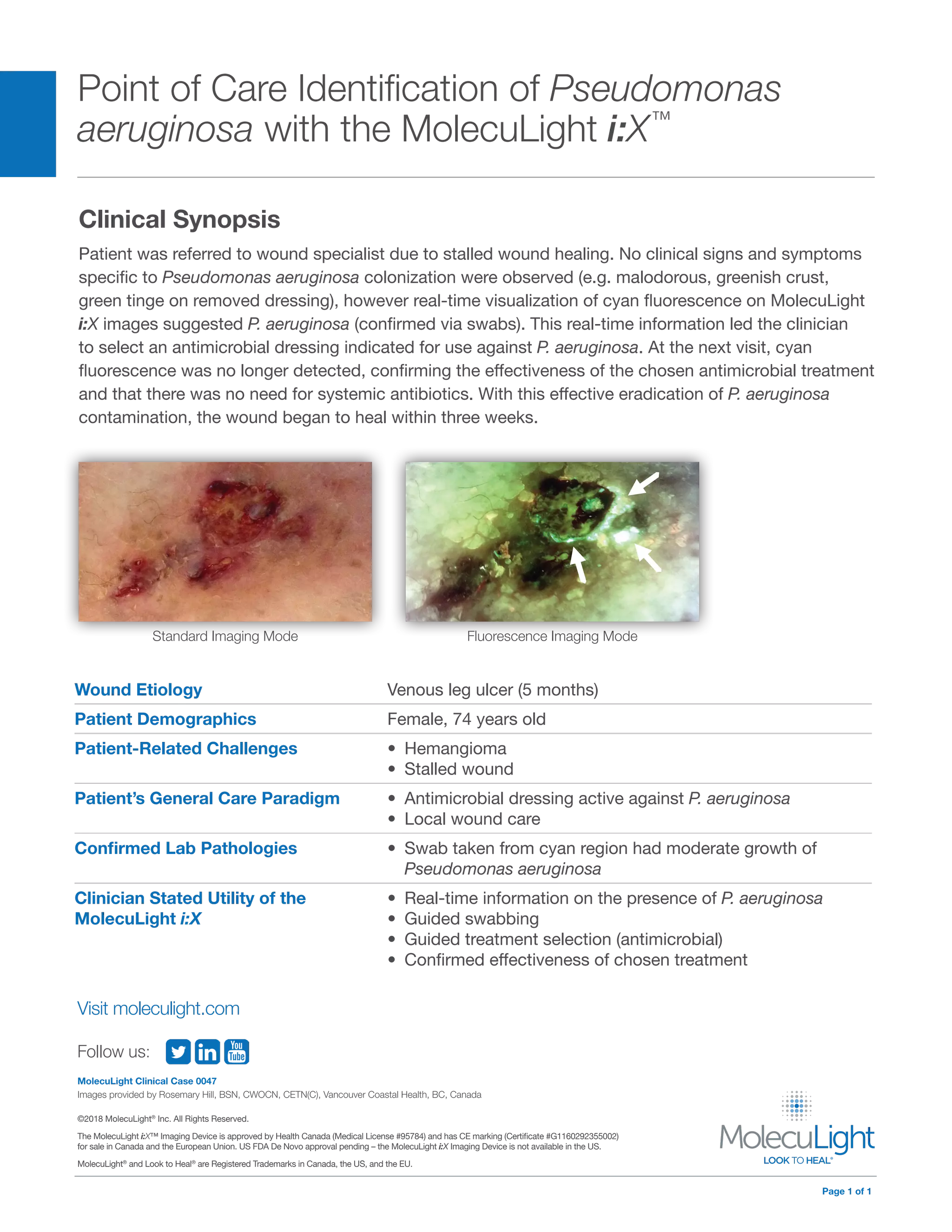 Point of Care Identification of Pseudomonas aeruginosa with the ...