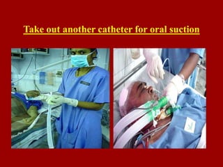 005 Suctioning.ppt