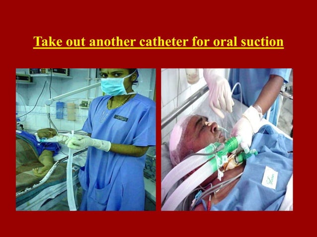 005 Suctioning.ppt