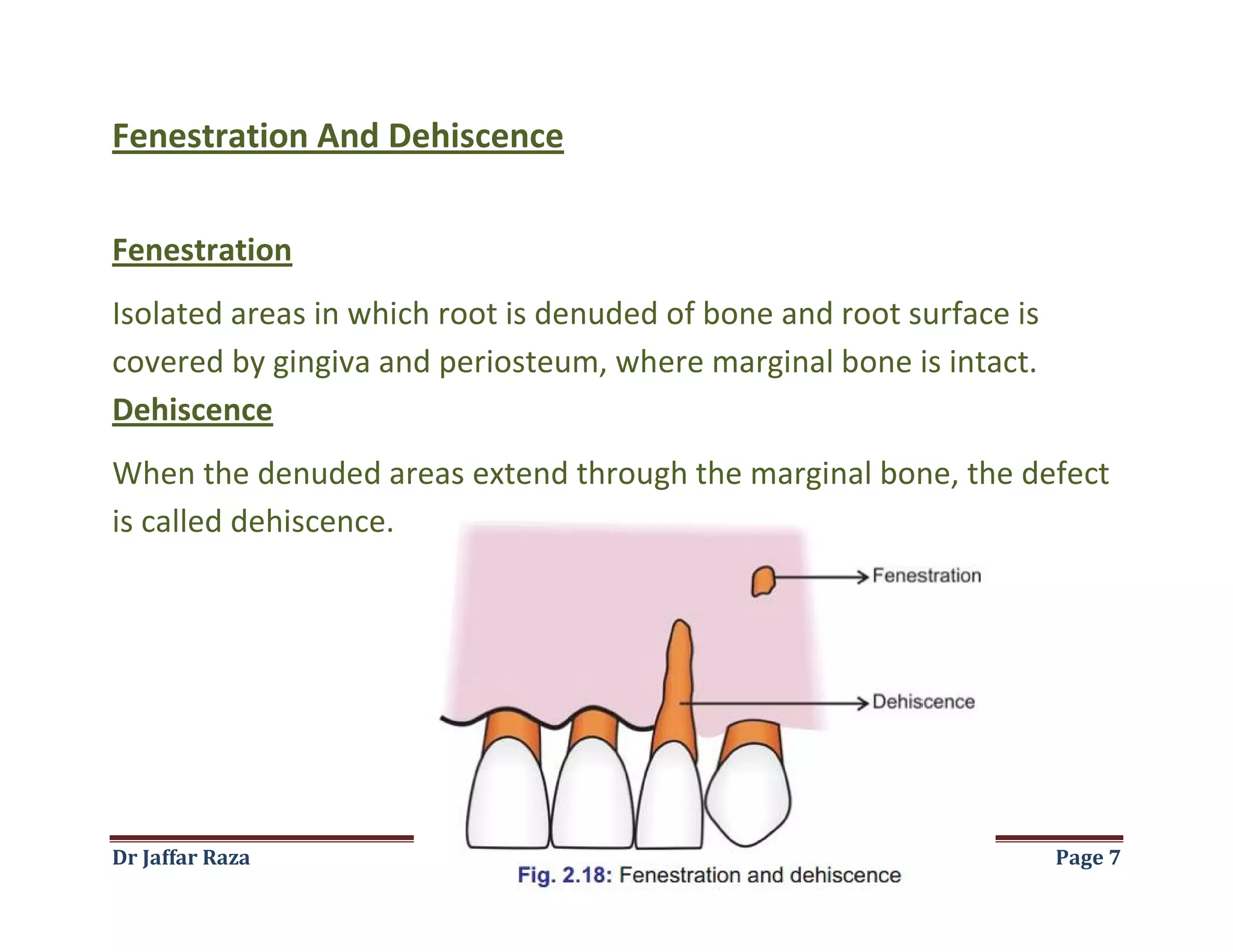 006.alveolar bone | PDF
