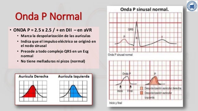 006 electrocardiograma primera parte