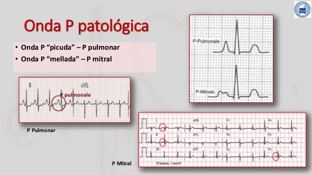 006 electrocardiograma primera parte