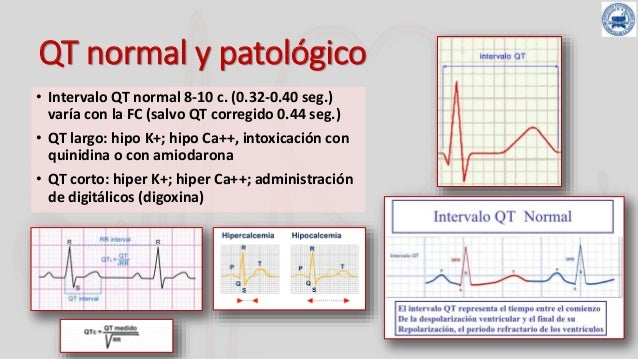 006 electrocardiograma primera parte