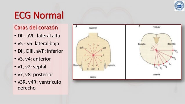 006 electrocardiograma primera parte