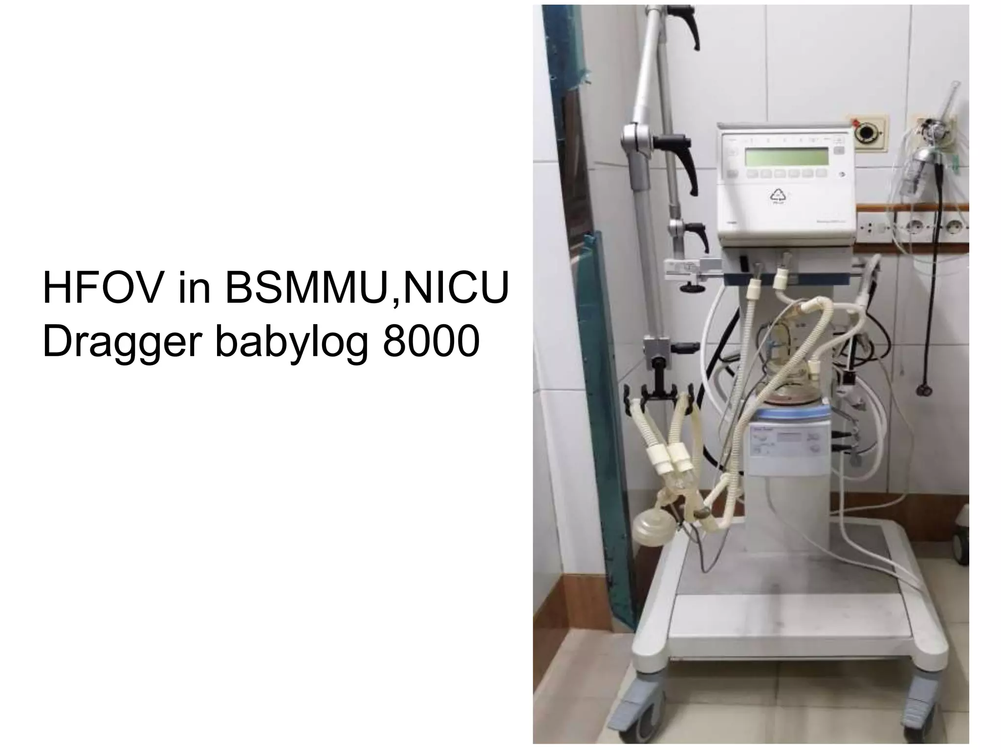 seminar on hfv - high frequency ventilation | PPT