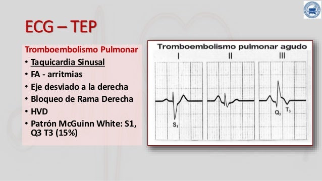 008 electrocardiograma tercera parte