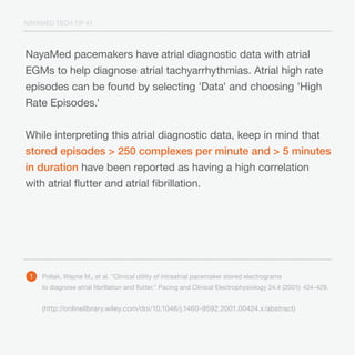 NayaMed - Tech Tip #1 | PDF