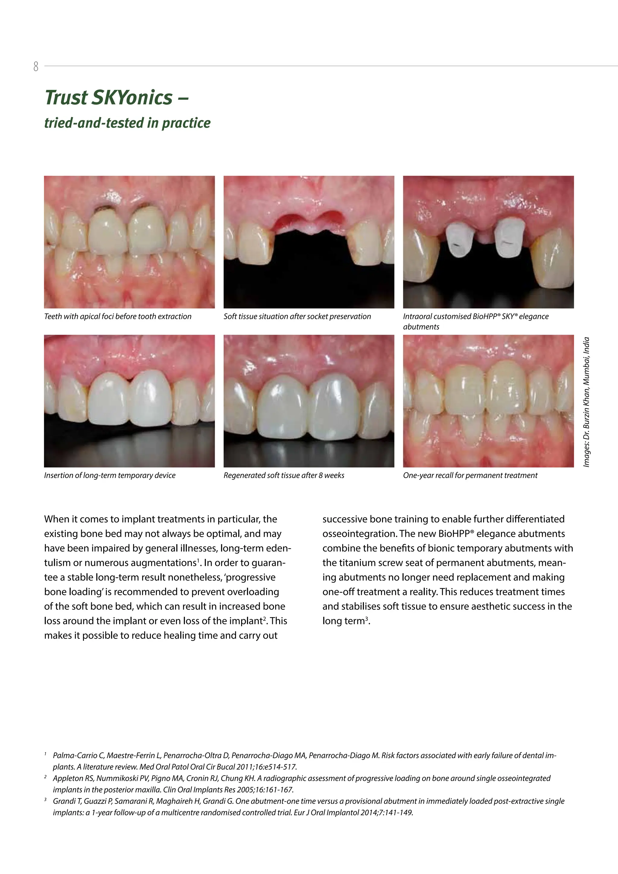 009912GB_SKYonics Implant Prosthetics.pdf